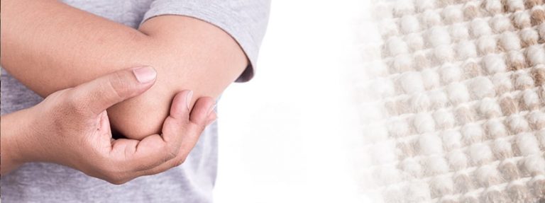 How to Treat Carpet Burns | Smart Choice Carpet